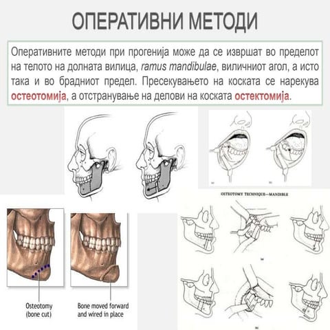 anomalii na dolna vilica 3 3.pptx