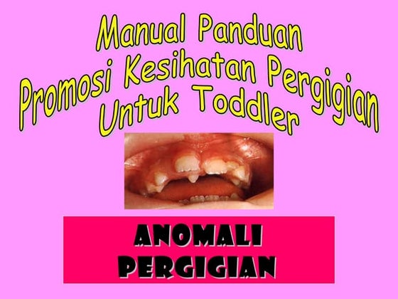 penyebab penyakit gusi berdarah pada mulut | PPT