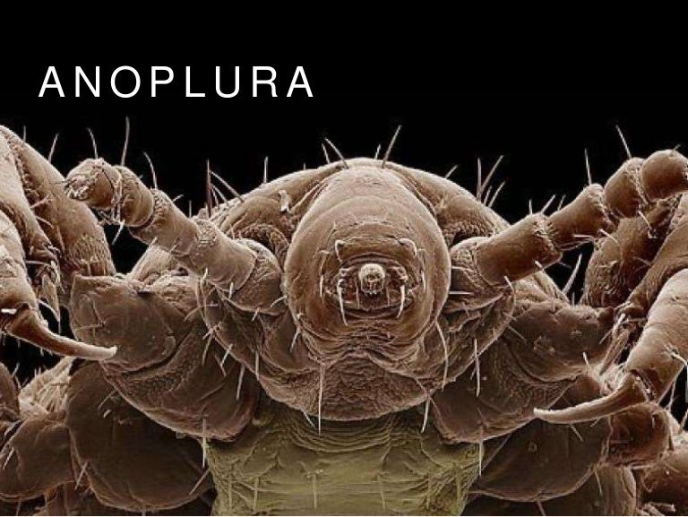 Anoplura