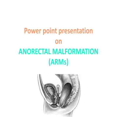 Invertogram ANORECTAL MALFORMATION ( ARM ) PRANAYA | PPTX