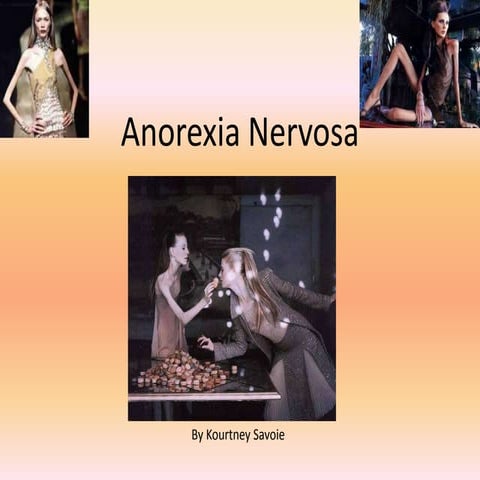 Anorexia Nervosa Project | PPTX
