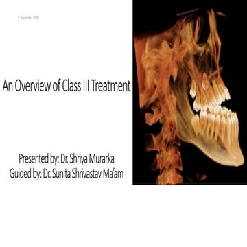 An overview of class III treatment in fixed Orthodontics by MBT system ...