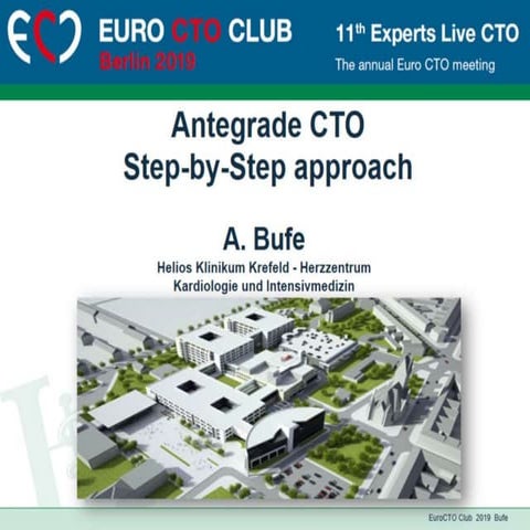 Antegrade – Step-by-step approach