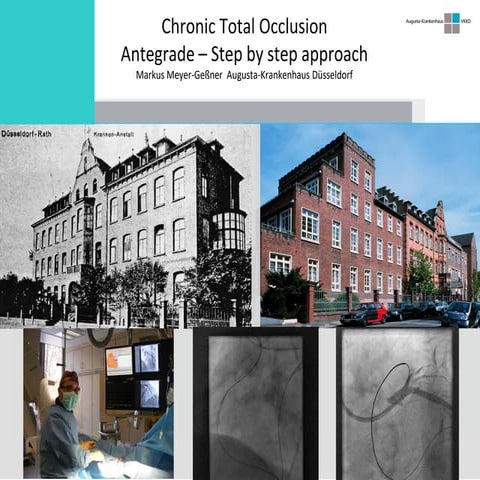 Antegrade – step by step approach | PDF