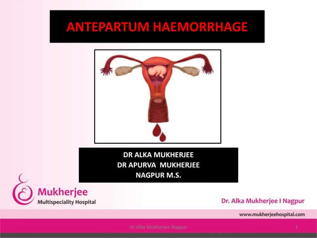 Antepartum haemorrhage | PPT