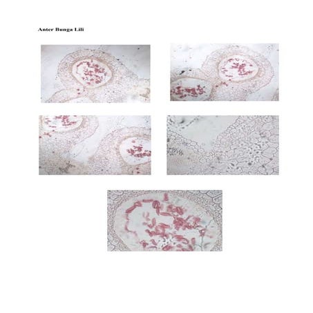 Anter bunga lili | DOCX