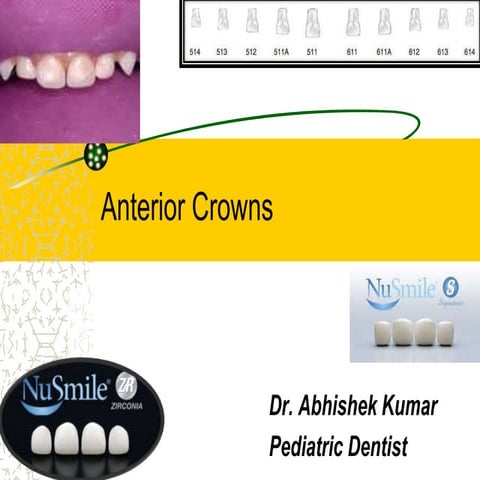 Anterior strip crown | PPTX