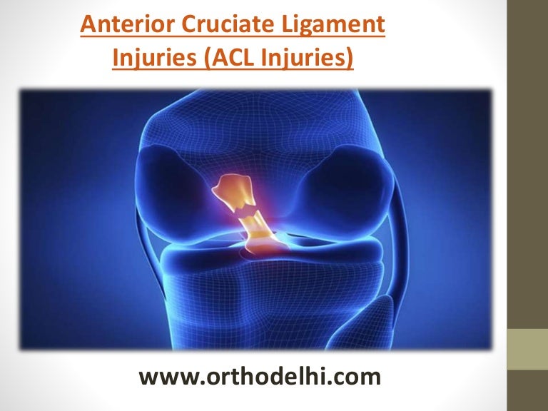 Anterior cruciate ligament injuries (acl injuries)