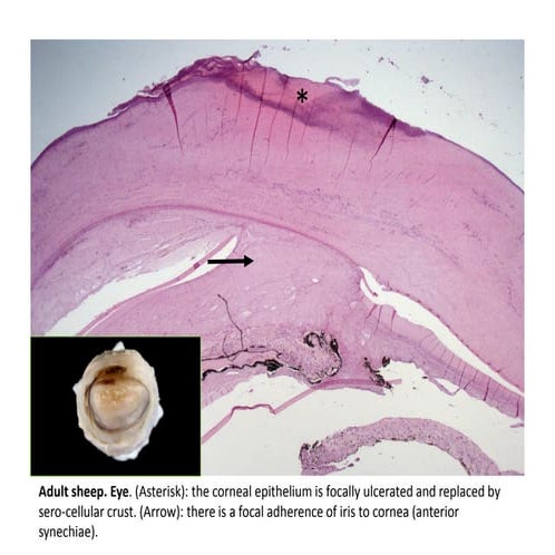 Anterior synechiae | PDF