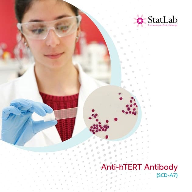 Anti hTERT-catalog - StatLab | PDF