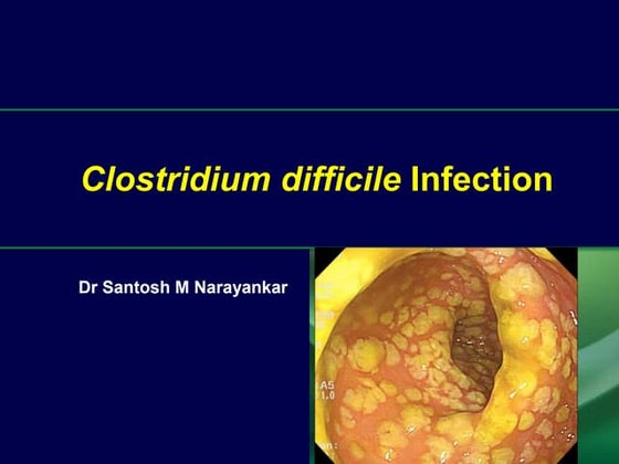 Clinical features & Diagnosis of Clostridium Difficile Infection.pdf