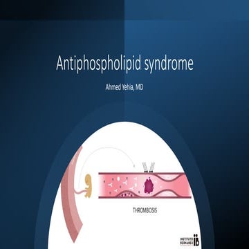 Antiphospholipid syndrome EULAR guidelines case based approach Ahmed ...