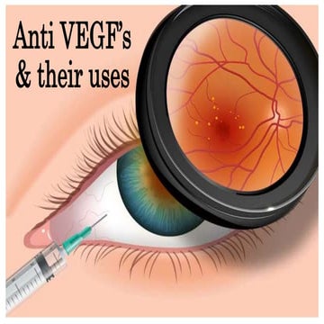 Anti VEGF in Ophthalmology | PPTX