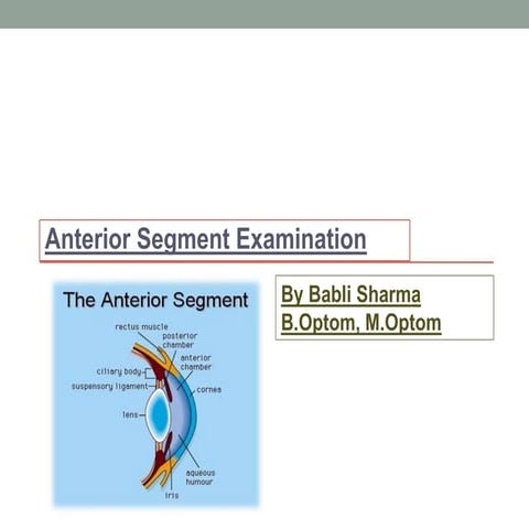 ANTERIOR SEGMENT EXAMINATION.PPTX....... | PPT