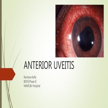 Uveitis Anterior Lesson: Identifying Systemic Sources Of Uveitis