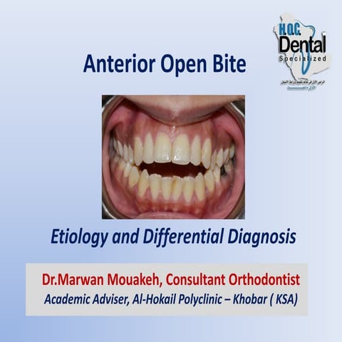 Classification of malocclusion | PPT
