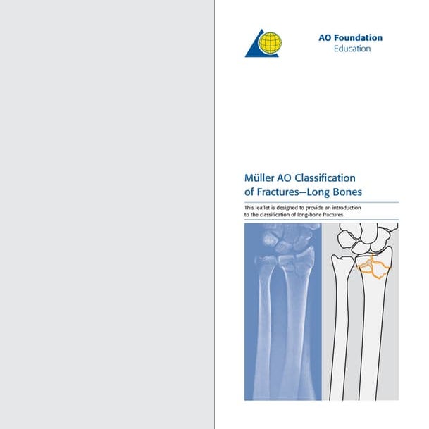 AO Classification | PPT