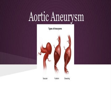 Aortic Aneurysm detailed explanation pptx | PPTX