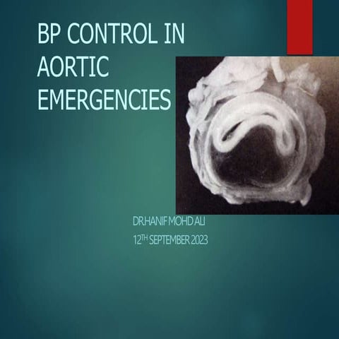 AORTIC DISSECTION and management of aortic dissection | PPTX