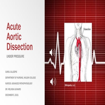 Aortic Dissection_Case Study.pptx