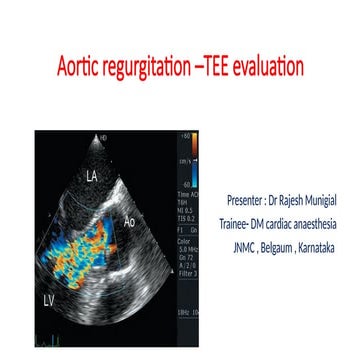 aortic regurgitation Tranesophhageal echocardiographic evaluation | PPTX