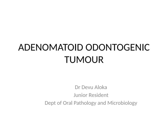 Adenomatoid odontogenic tumor | PPTX