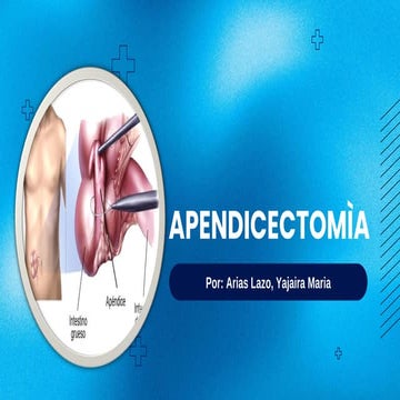 APENDICECTOMIA DIAPOSITIVAS [Autoguardado].pdf