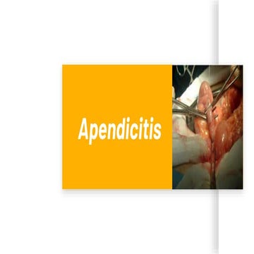 Bring Your Favorite Kafka to Java EE with CDI | PPTX