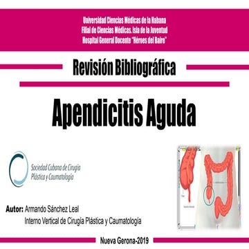 Signos clínicos en apendicitis aguda | PDF
