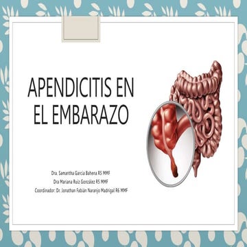 Apendicitis en el embarazo artículo de revisión | PPTX