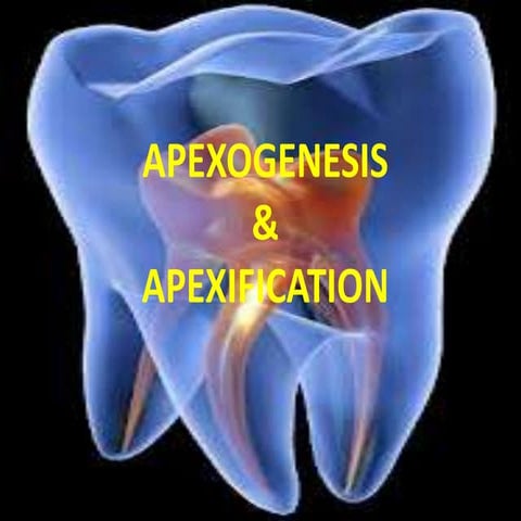 Apexogenesis | PPTX