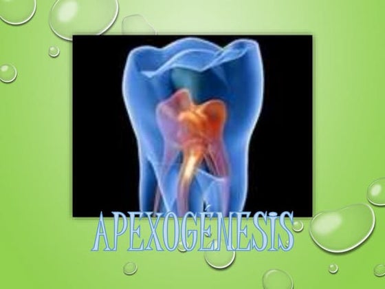 Apexogenesis & apexification | PPTX | Dental Health | Diseases and ...