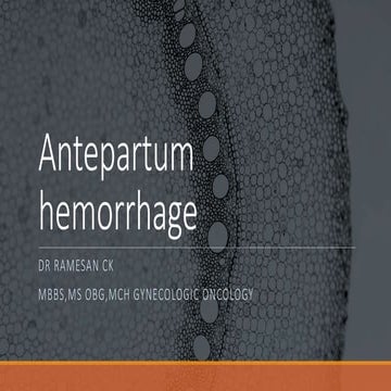 antepartum hemorrhage diagnosis and management | PPTX