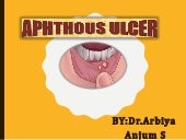 Aphthous Ulcer | PPT