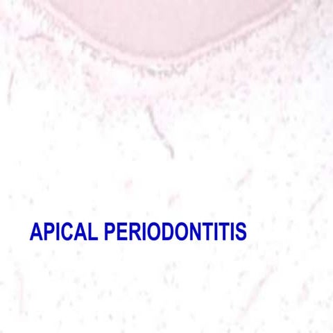 Apical periodontitis. tooth inflammation.ppt