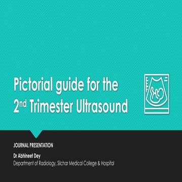 A pictorial guide for the 2nd Trimester USG | PPTX