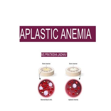 Aplastic anemia -.pptx