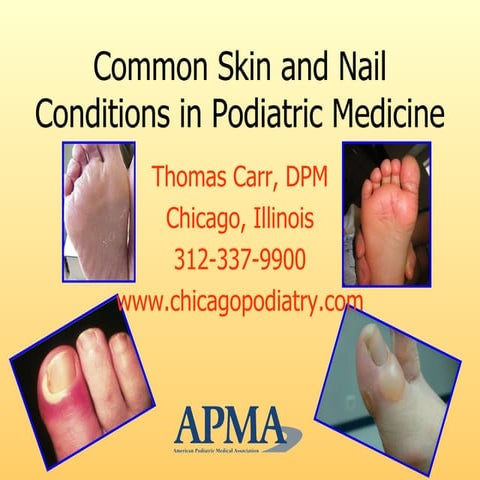 Pedicure contra-indications | PPT