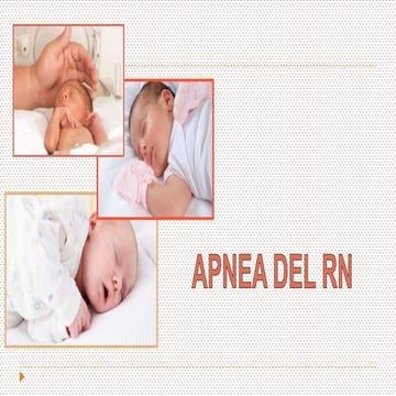 Apnea del Recién Nacido | PPTX