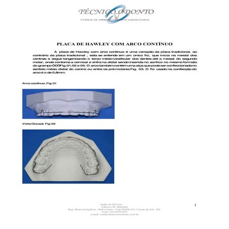 Apostila Placa De Hawley Com Arco Arco ContíNuo | DOC