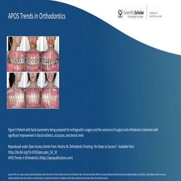 APOS Trends in Orthodontics (4).pptx