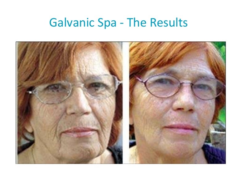 Many before and after photos showing the power of ageLOC technology