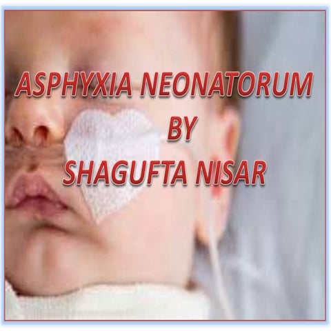 Neonatal asphyxia | PDF
