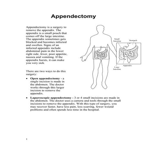 Appendectomy dich thuat phien dich cnn | PDF