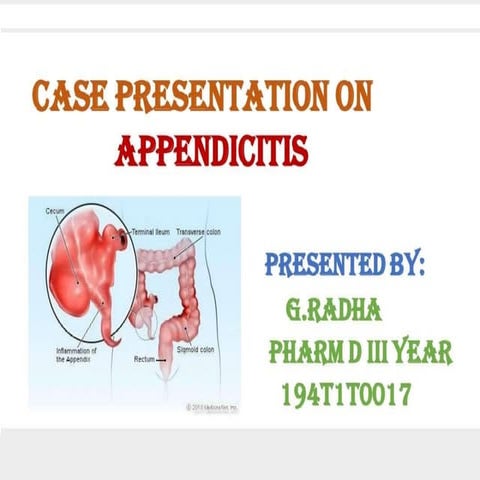 APPENDICITIS-2.pptx