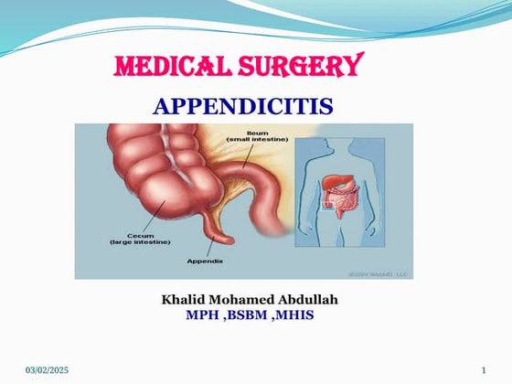 Appendicitis | PPTX | Digestive Disorders | Diseases and Conditions
