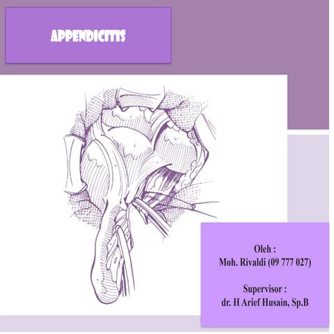Appendicitis perforated presentation medical.pptx