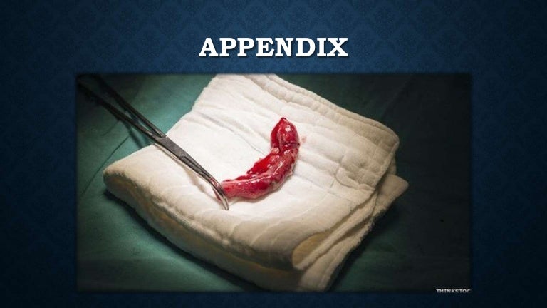 Appendix