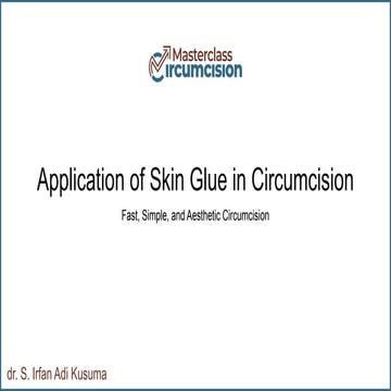 Application of Skin Glue in Circumcision.pdf