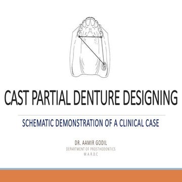 Cast partial denture design | PDF